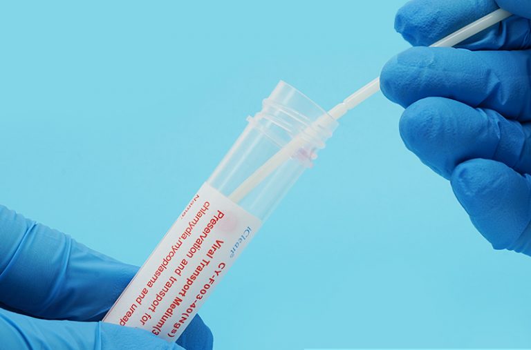 What is a Flocked Swab? 5 advantages of nylon flocking swabs - A ...