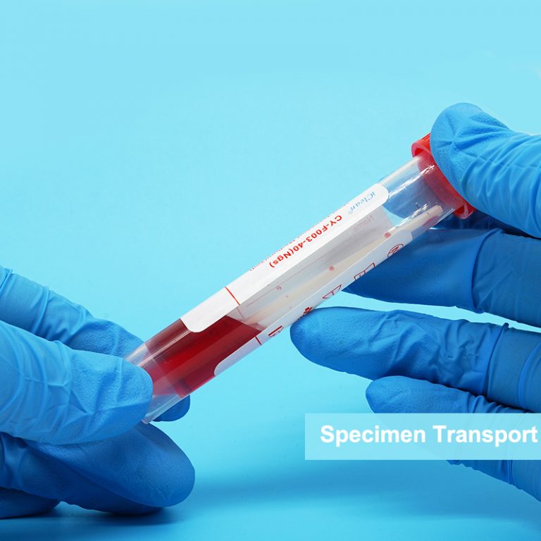 What is VTM? 3 uses for VTM swab and viral transport tube - A ...