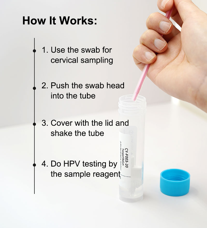 HPV Swab, HPV Collection Kit - A professional supplier of swabs